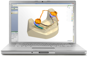 Orthodontic CAD System for Labs from SculptCAD
